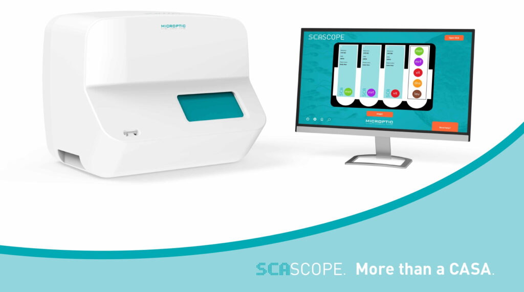 SCA Scope – Fully Automated – Human – Synergy Medical Systems LLP